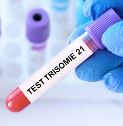 Tri test - Palazzo della Salute